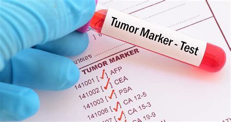 Tumor Marker Tests Guiding The Path To Cancer Diagnosis And Treatment