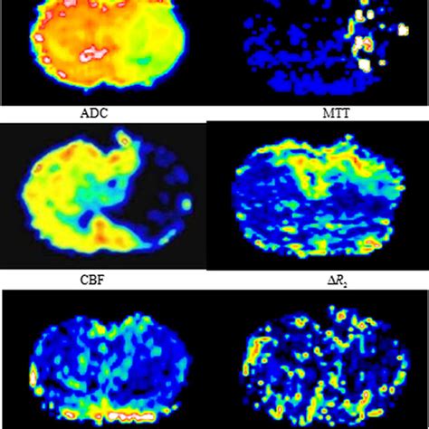 A Absolute And B Relative Ct Perfusion Mismatch Versus Time From Download Scientific Diagram