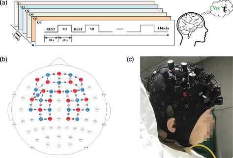 Figure 2 From Evaluation Of Residual Cognition In Patients With Disorders Of Consciousness Based