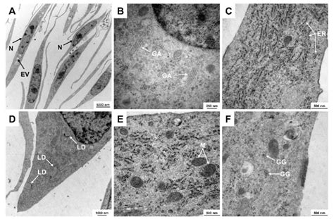 Representative Electron Microscopic Analysis Of CFSC 2G Typical