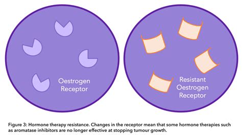 Secondary Hr Breast Cancer Whatve Hormones Got To Do With It Owise Uk