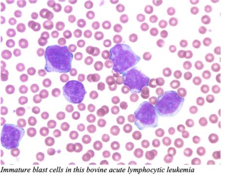EXAM 1 Hematopoietic Neoplasia Flashcards Quizlet