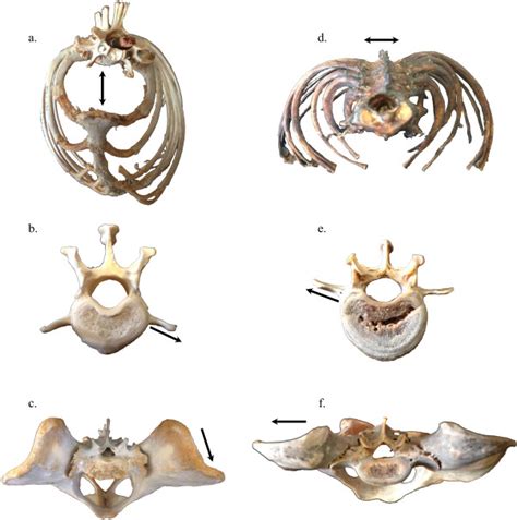 Trunk Shape In Cercopithecoids And Hominoids Superior View Of The Download Scientific Diagram