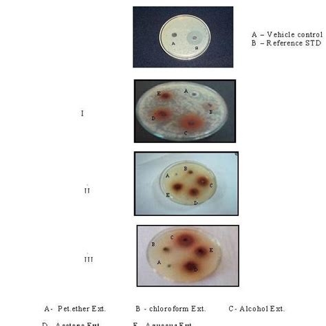 Antimicrobial Activity B Subtilis Download Scientific Diagram