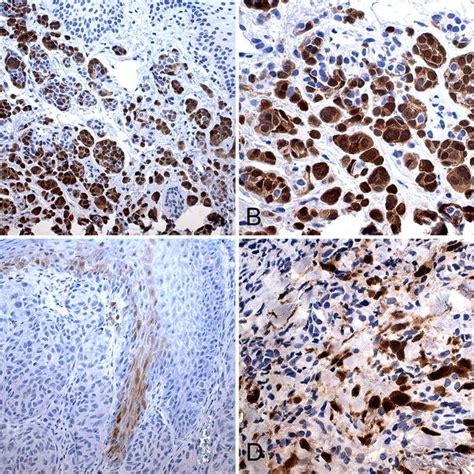 Pdf Immunohistochemical Expression Of P16 P21 P27 And Cyclin D1 In