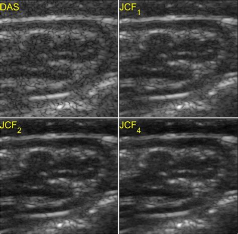 Adaptive Ultrasound Beamforming Biomicroscopy Lab