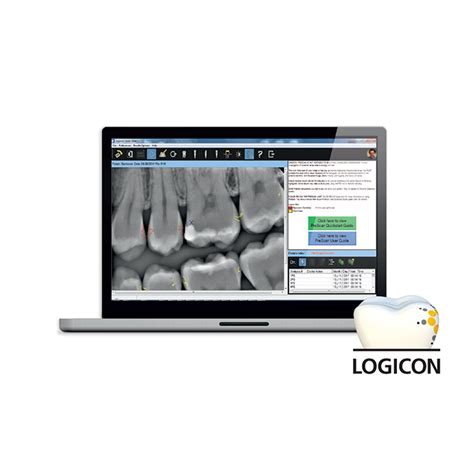 Clinical Software Carestream Dental