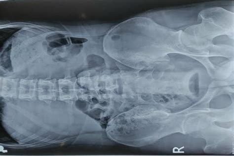 Tphcm Một Nam Thanh Niên Tự Sướng” Bị Kẹt Dương Vật Giả Dài 25cm