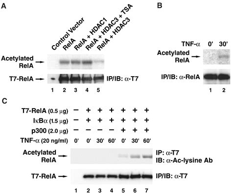 Duration Of Nuclear Nf κb Action Regulated By Reversible Acetylation