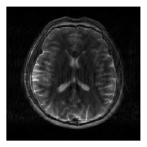 reconstructed brain images at 40 undersampling a the fully sampled