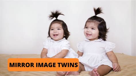Ppt Get Some Facts On Types Of Twins Powerpoint Presentation Free