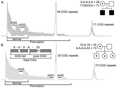 AGG Interruptions Within The Maternal FMR1 Gene Reduce The Risk Of