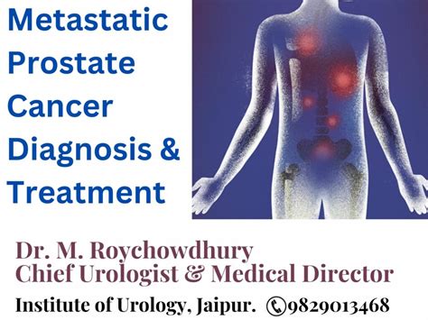 Relationship Between Prostate Cancer And Bone Cancer At Ashley Smalley Blog