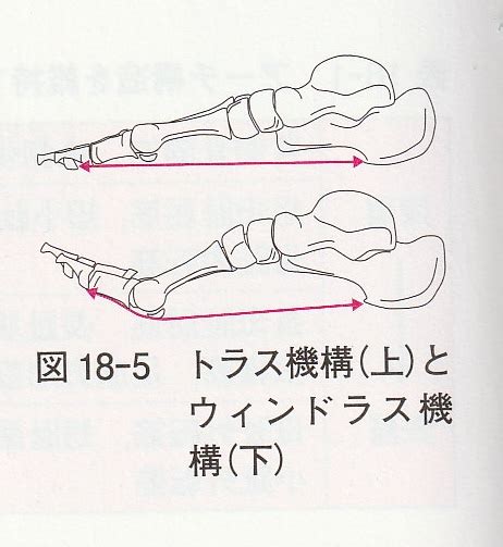 足の裏が痛い足底腱膜炎 はるやま鍼灸整骨院公式ブログ 神戸市北区の鍼灸整骨院 はるやま鍼灸整骨院