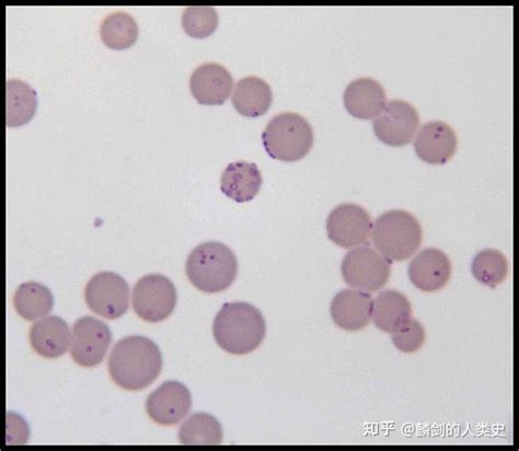 地球生物全系列从单细胞到人类细菌界柔膜菌门 知乎