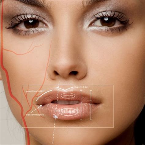 top 3 botox injection patterns markup skinviva training botox