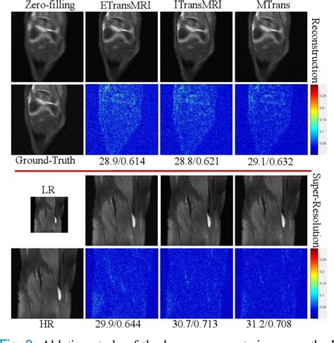 Figure 1 From Multimodal Transformer For Accelerated Mr Imaging Semantic Scholar