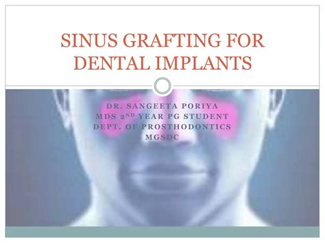 Sinus Lift With Implant Placement Surgical Approach Pptx