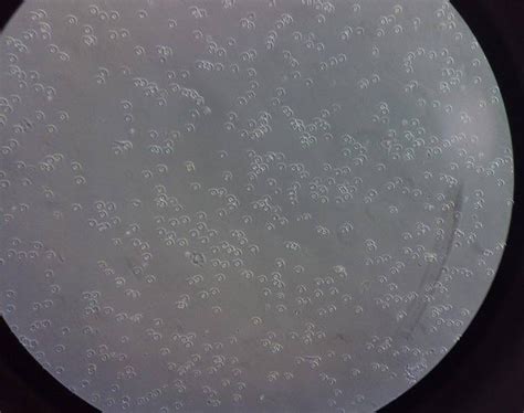 Seeding The Hl 60 Cells Summer Project 2016 School Of Life Sciences