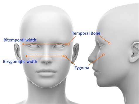 Why Is A Larger Bi Temporal Width In Comparison With Bi Zygomatic Width