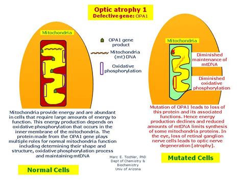 Optic Atrophy Hereditary Ocular Diseases