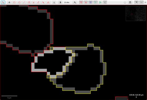 topographic analysis in qupath image analysis image sc forum