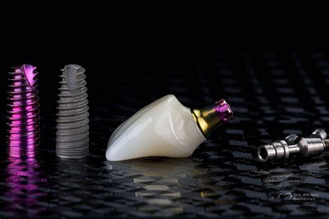 Tipos de implantes dentales Dra Adriana Gutiérrez