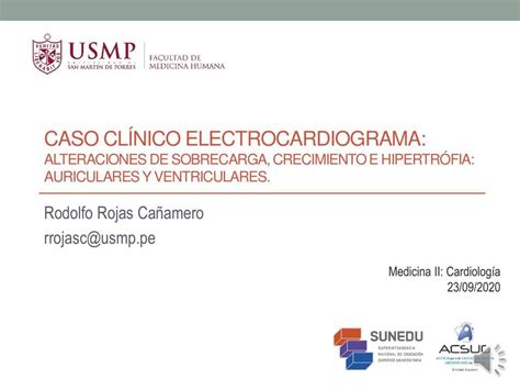 Caso Clínico Electrocardiograma Jocelyn Aranda Rabanal uDocz