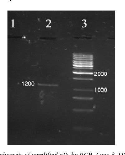 Figure 1 From Construction Of An Eukaryotic Expression Vector Encoding