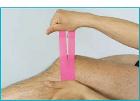 Chondromalacia Patella Kinesio