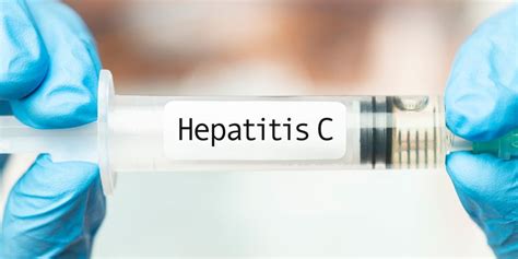 Diagnosis Treatment Of Hepatitis C Using Point Of Care Assays Clinicallab
