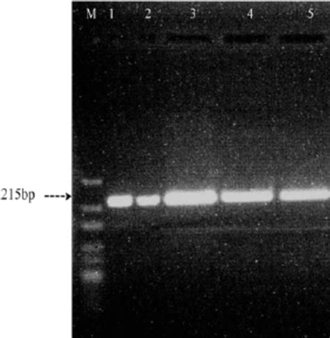 Digestion Of Pcr Products With Rsa1 Restriction Enzyme Lane M Contains