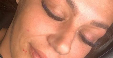 Vereinbare Einen Termin Bei Elaeya Medical Aesthetics Bramalea City