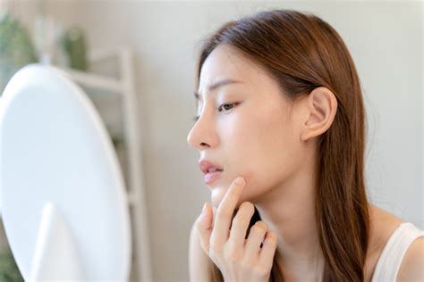 ダーマペンで毛穴の状態が悪化することはある？効果や改善のポイントを紹介｜アリエル美容クリニック 大宮院