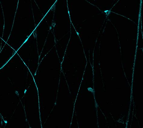 Axonal Regeneration In Motor Neurons Derived From Human Ipscs Crestoptics