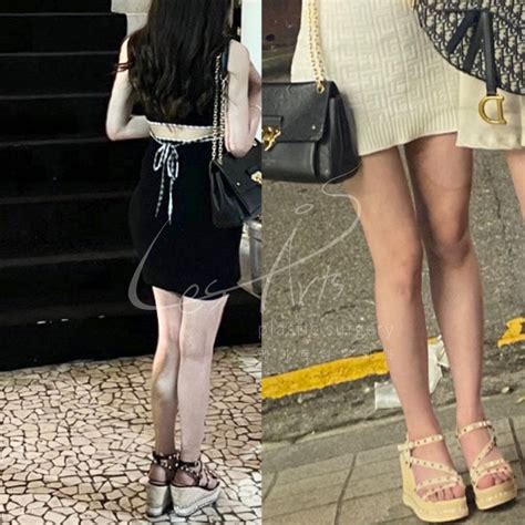 日本人の患者様のリアルレビュー紹介です！ 【韓国整形 美容整形】レアート整形外科公式ブログ