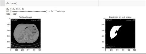Sahbi Bannour On Linkedin Deeplearning Opensource Unet