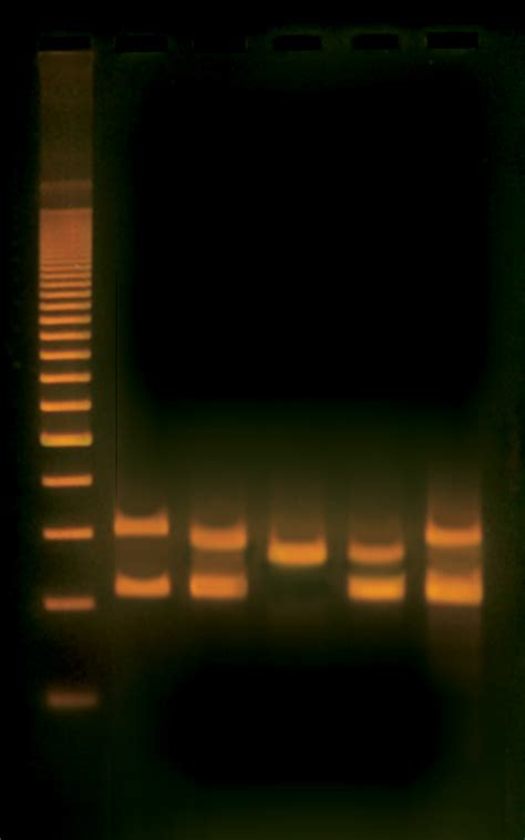 Pcr Based Vntr Human Dna Typing Adapted From Fbi Technology Biotek