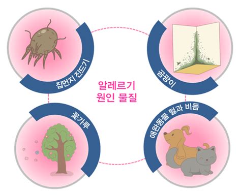 알레르기 비염의 이해와 관리 ③ 네이버 블로그