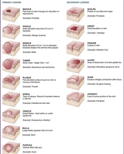 Pin On Medical