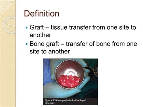 Bone Graft Substitute Bmpppt