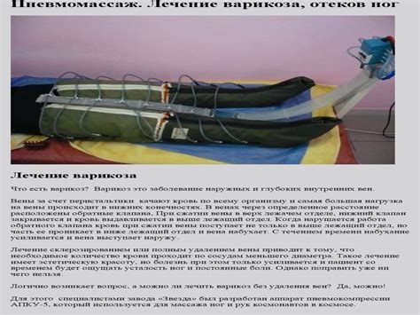 Артроз коленного сустава гонартроз деформирующий артроз презентация онлайн