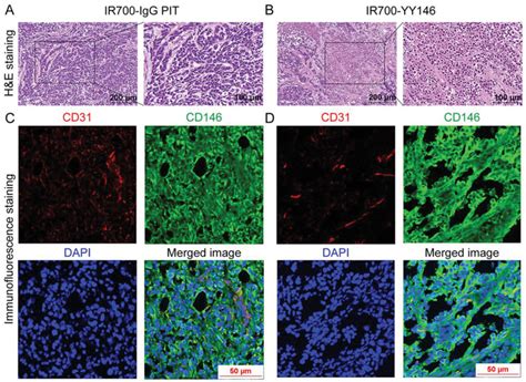 Hande And Immunofluorescence Staining Of A375 Tumors Collected From