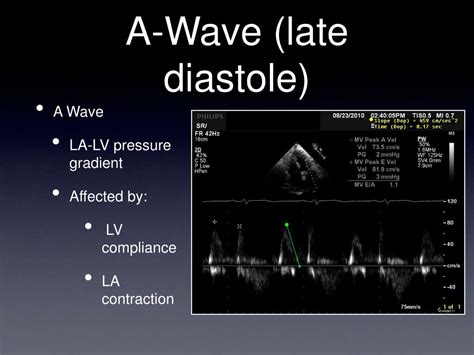Ppt Ventricular Diastolic Filling And Function Powerpoint Presentation Id 4598551