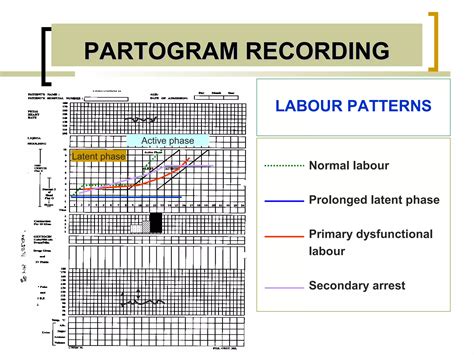 Partogram Ppt