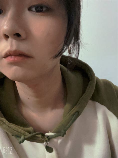 你隐姐🏳️‍⚧️是隐形眼镜的隐 On Twitter 喉结术后一周，里面硬硬的不知道是什么