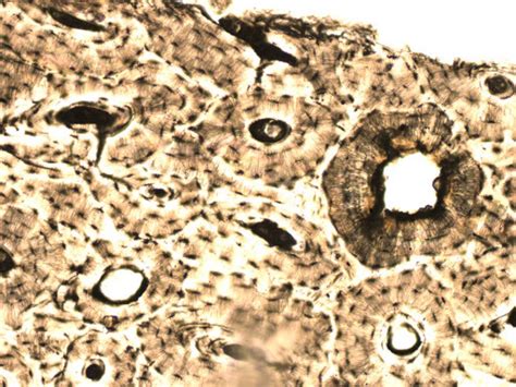 Osseous Tissue Diagram Quizlet