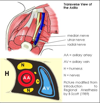 apuntalar biografía Intestinos axillary brachial plexus block vagón