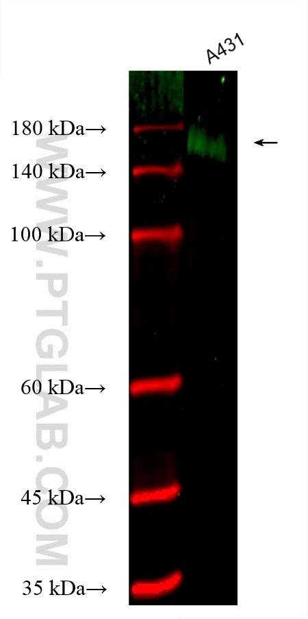 Egfr C Terminal Antibody Cl488 51071 Proteintech