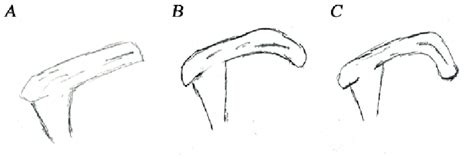 Types Of The Acromion Atype I Acromion Flat B Type Ii Acromion